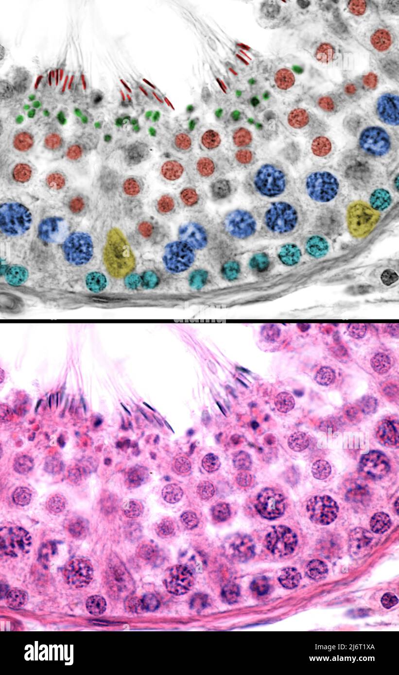 Spermatogenesis in human testicle, light micrographs Stock Photo - Alamy