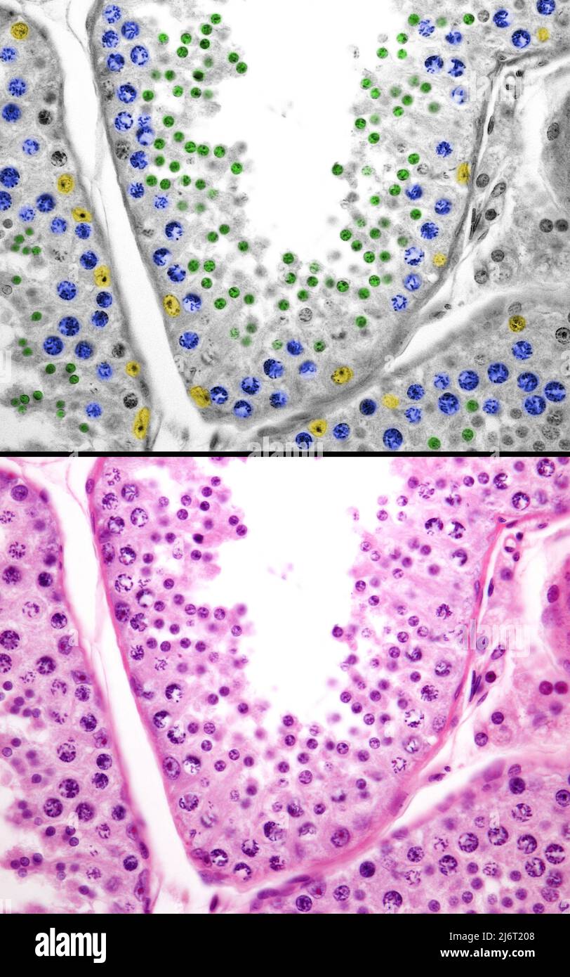 Spermatogenesis in human testicle, light micrographs Stock Photo - Alamy