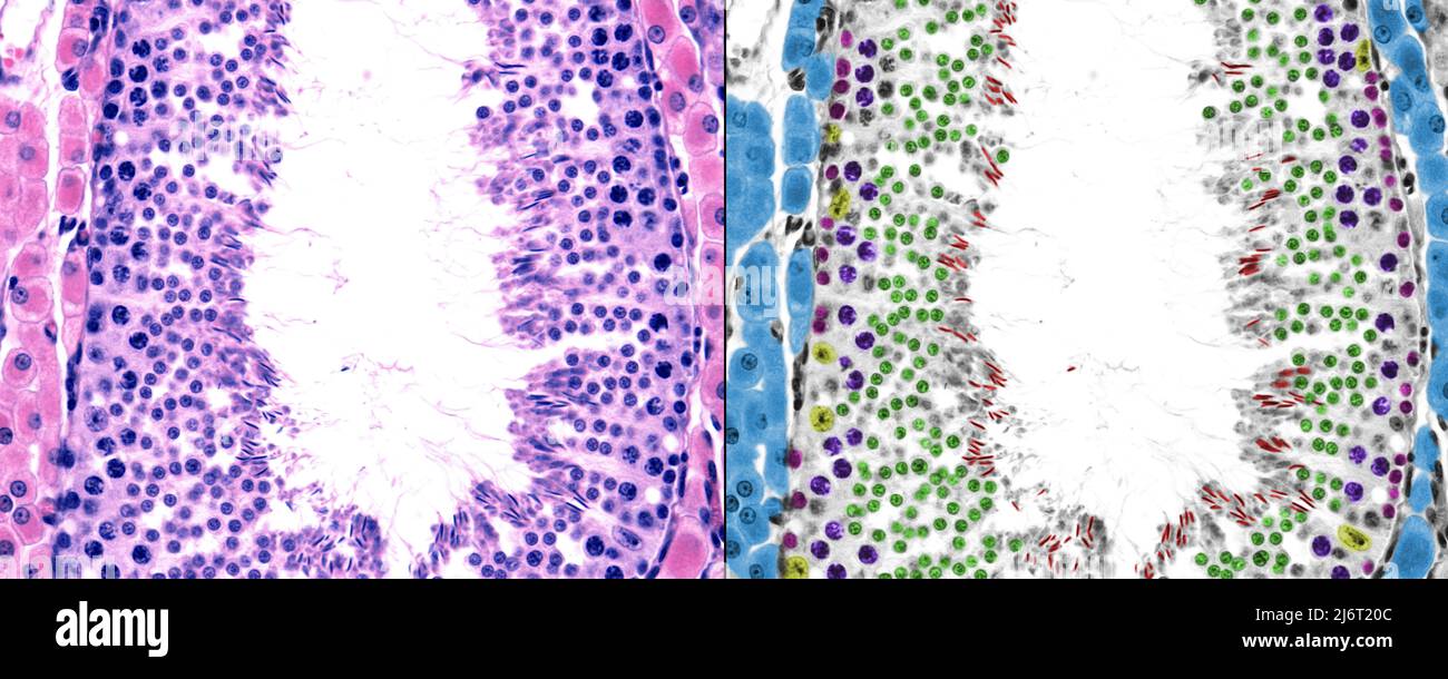Seminiferous tubules and Leydig cells, light micrographs Stock Photo ...