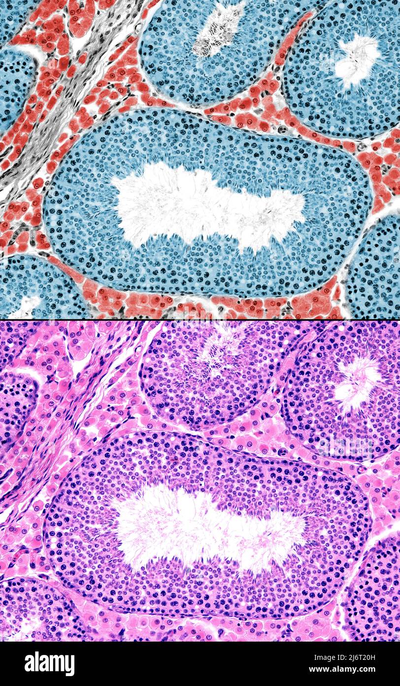 Testicle Leydig cells, light micrographs Stock Photo - Alamy