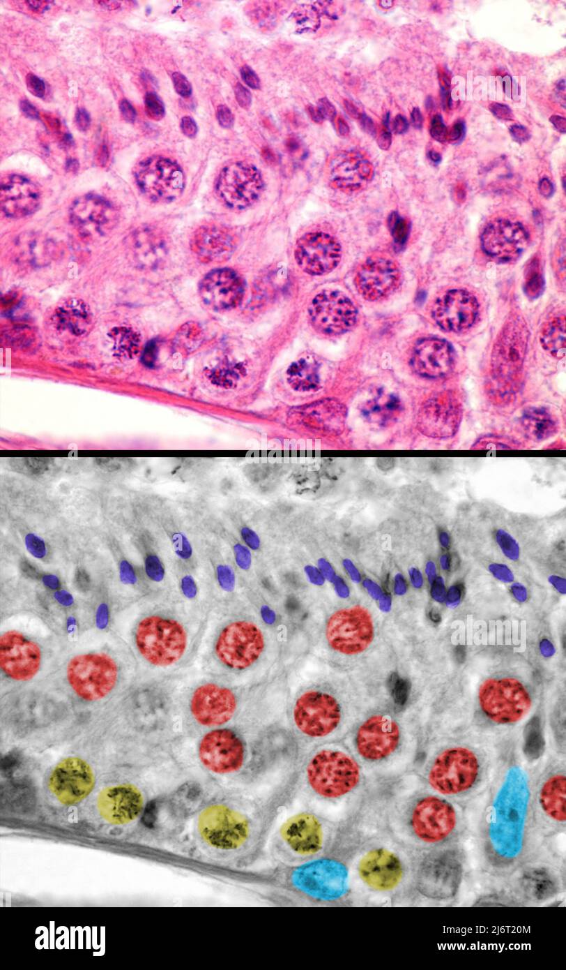 Spermatogenesis in human testicle, light micrographs Stock Photo - Alamy