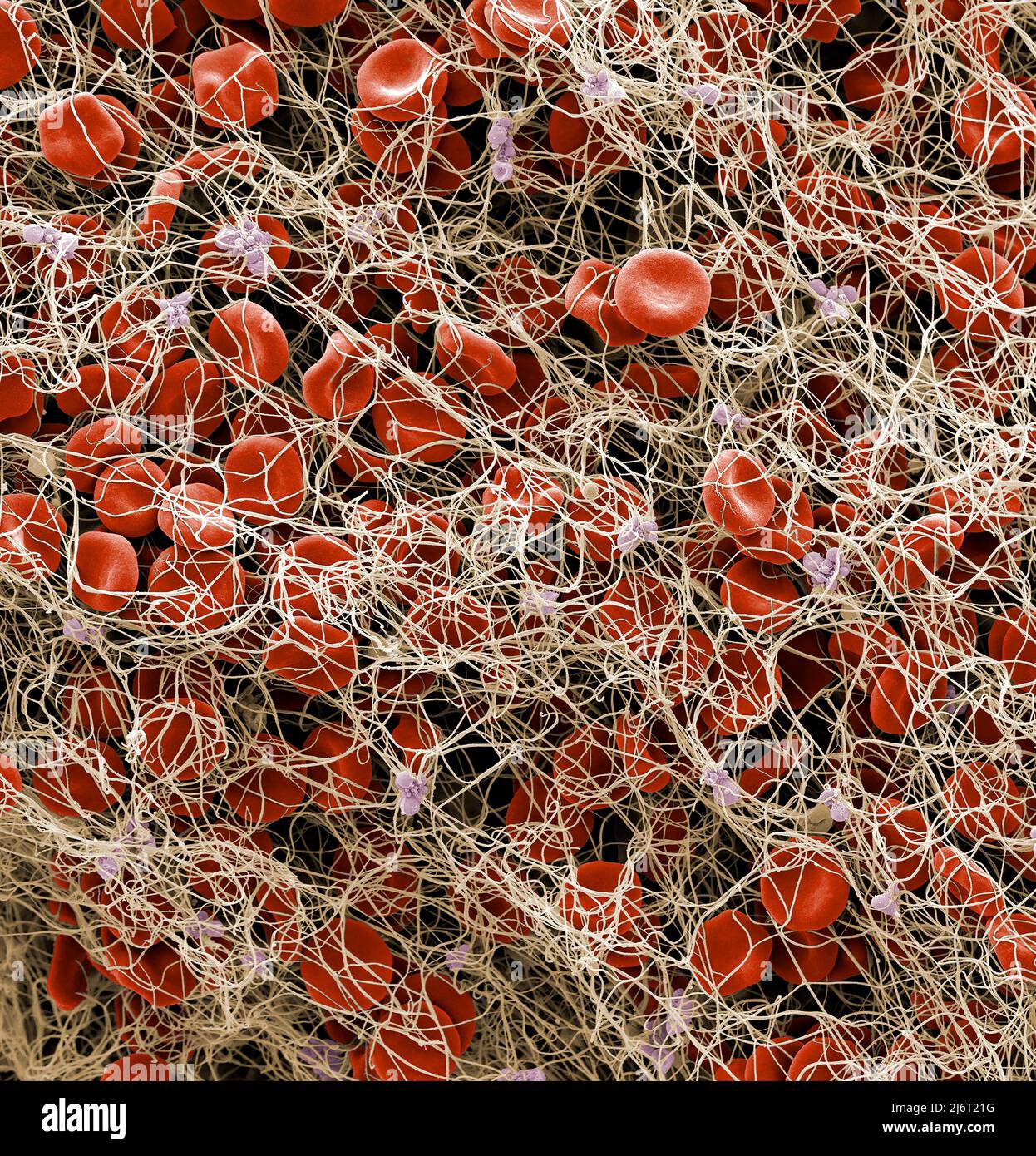 Red blood cells and platelets in blood clot, SEM Stock Photo - Alamy