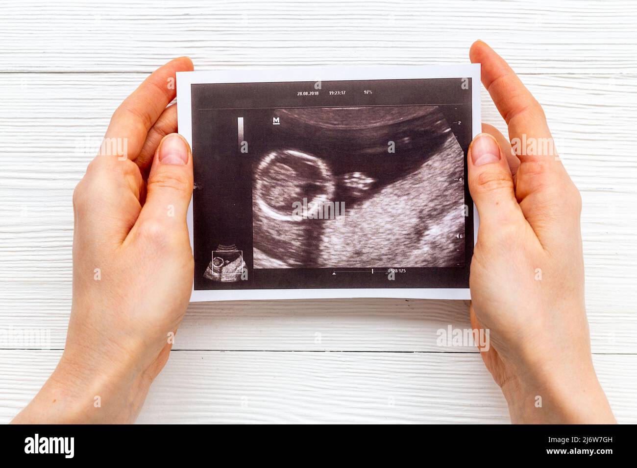 Womans hands holding ultrasound scan of unborn baby. Pregnancy ...