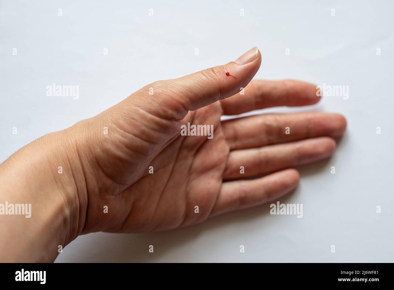 a finger on his hand was accidentally wounded with a knife Stock Photo ...