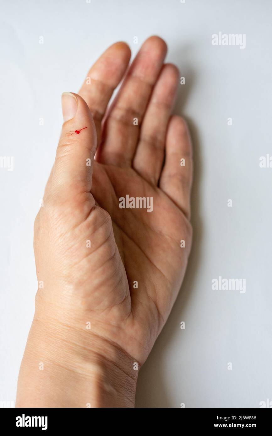 Bleeding Hand Cut
