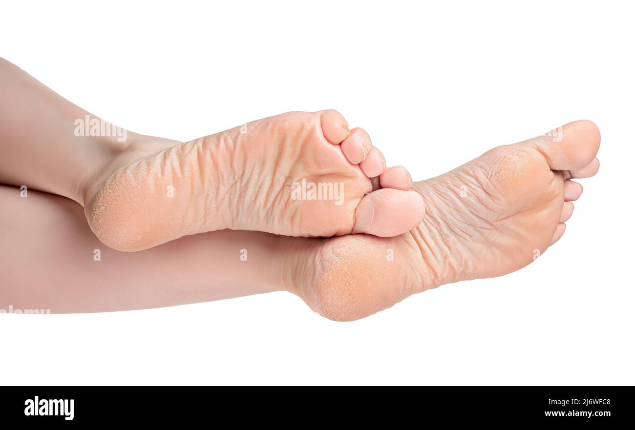 Soles feet woman hi-res stock photography and images - Alamy