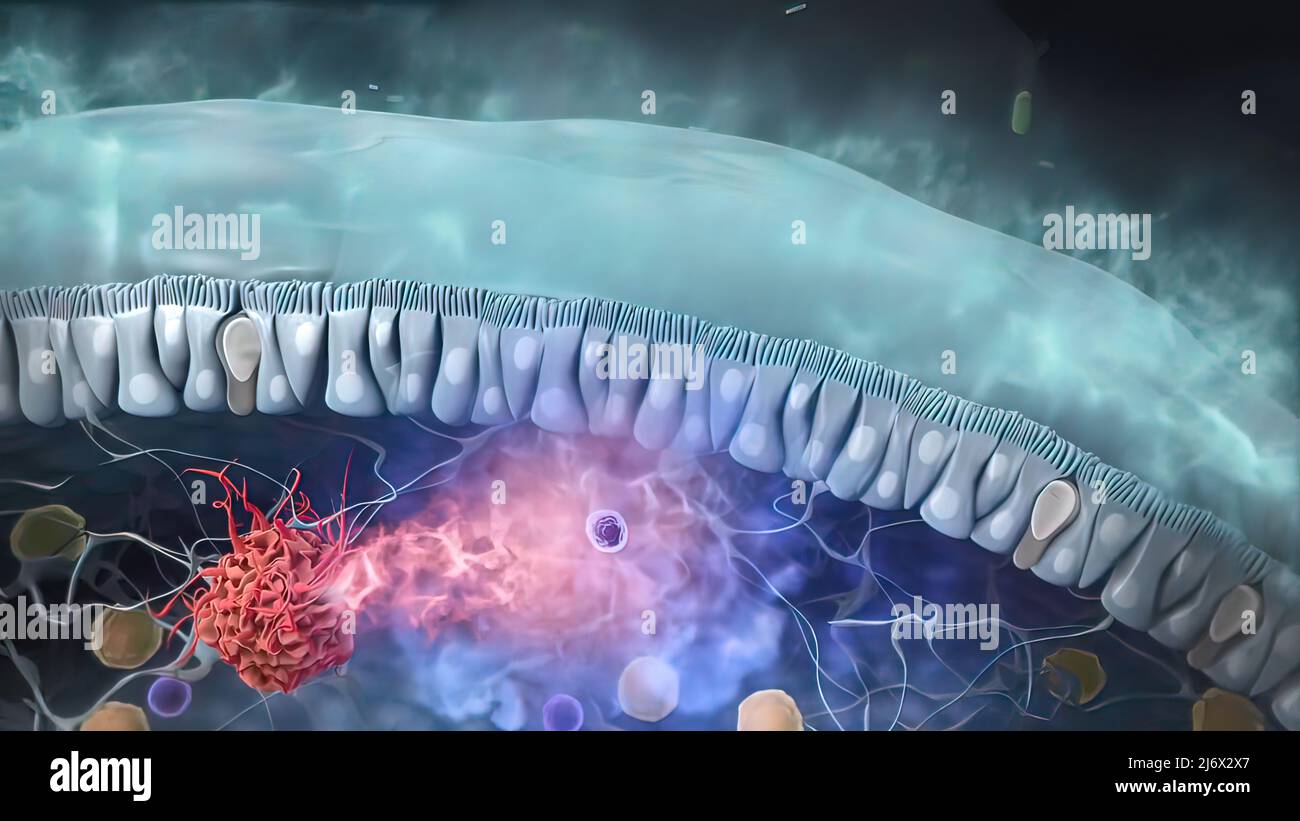 Innate Lymphoid Cells High Resolution Stock Photography and Images - Alamy