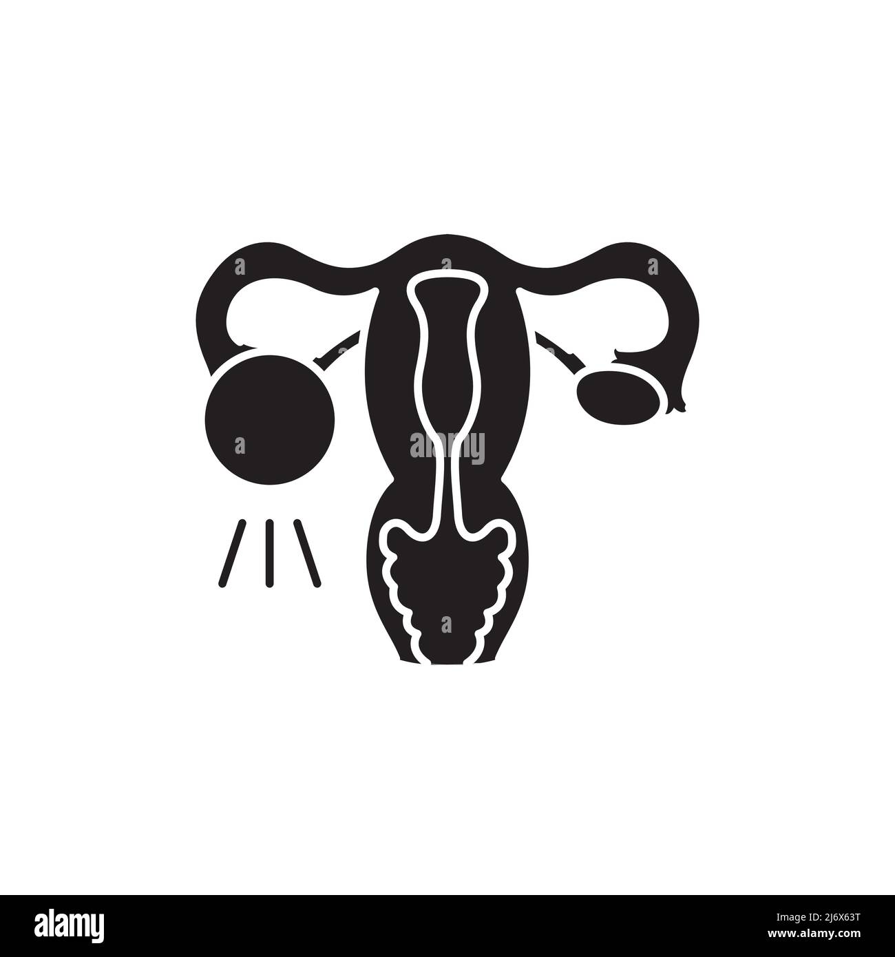 (pcos) Cut Out Stock Images & Pictures - Alamy