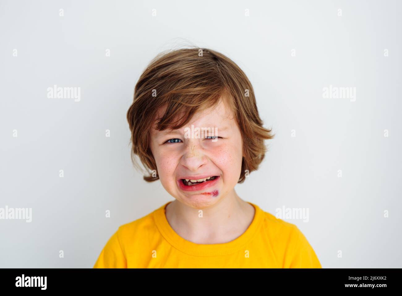 Portrait of school boy kid child crying due to sore bruised wound on ...