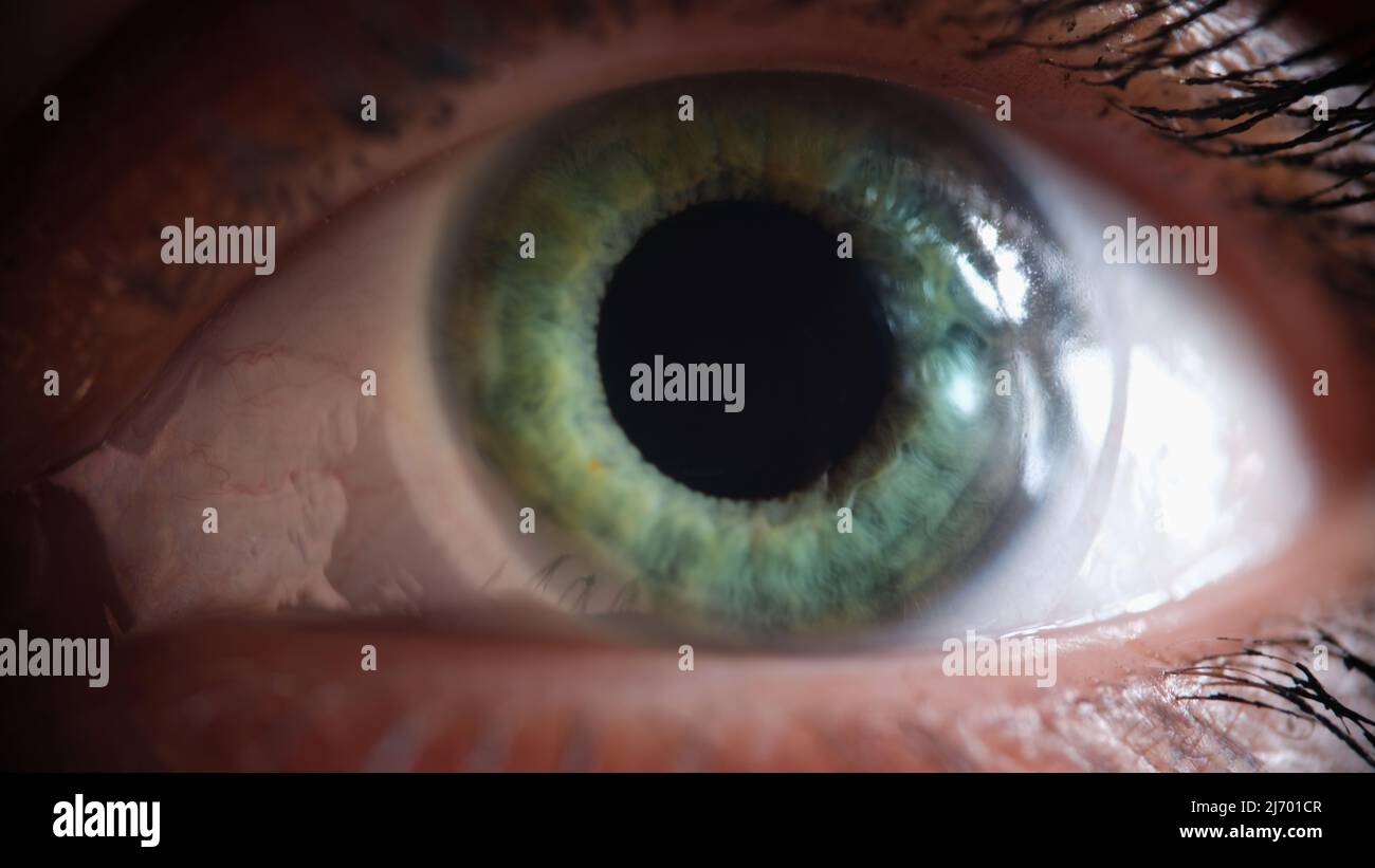 Gray cataract hi-res stock photography and images - Alamy