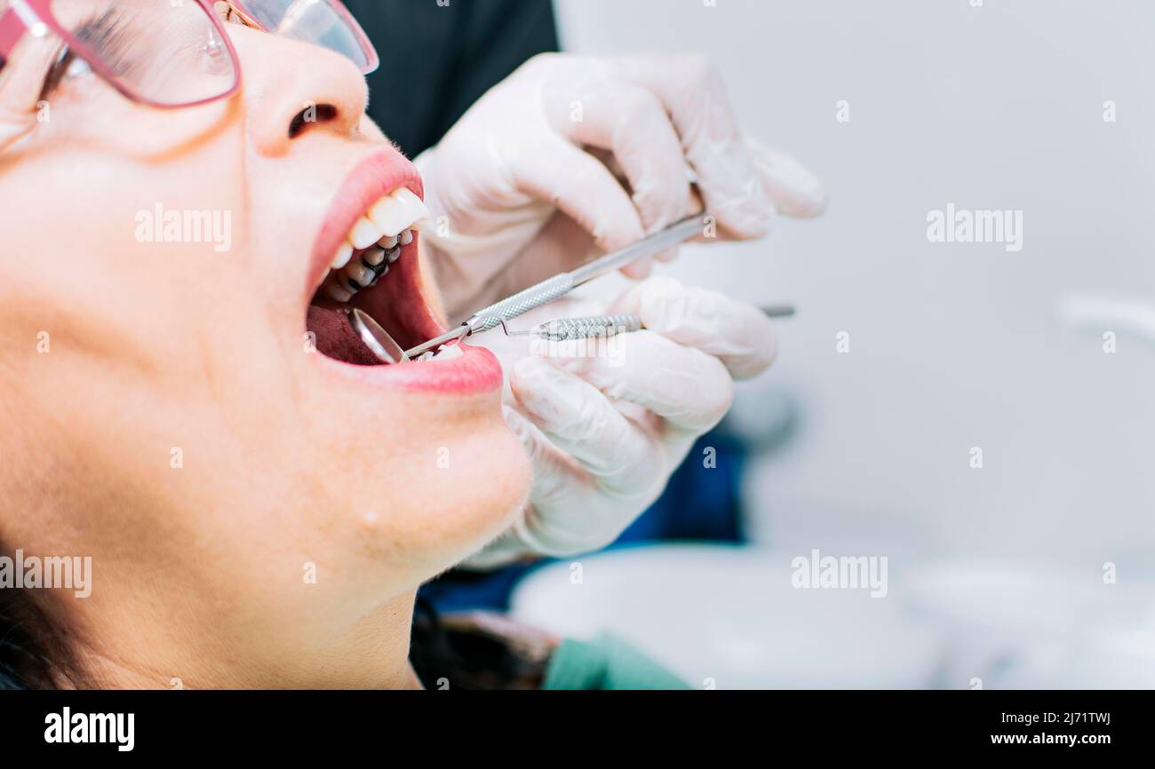 Close up of patient checked by dentist, Dentist checking patient's ...