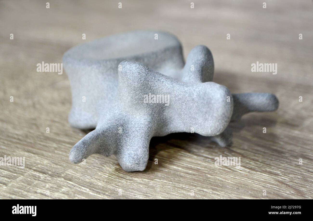 Prototype human spine bone printed on 3D printer. Model printed on 3D ...