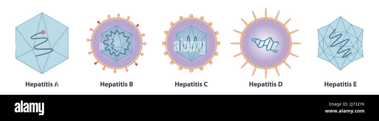 Five main types of viruses cause hepatitis: hepatitisviruses A (HAV), B ...
