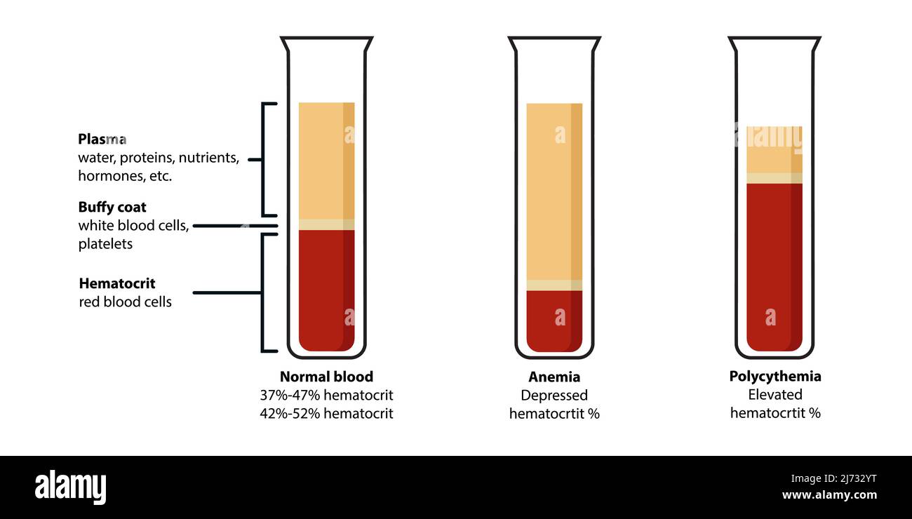 Сorrelation between red blood cells (erythrocytes), white blood cells ...