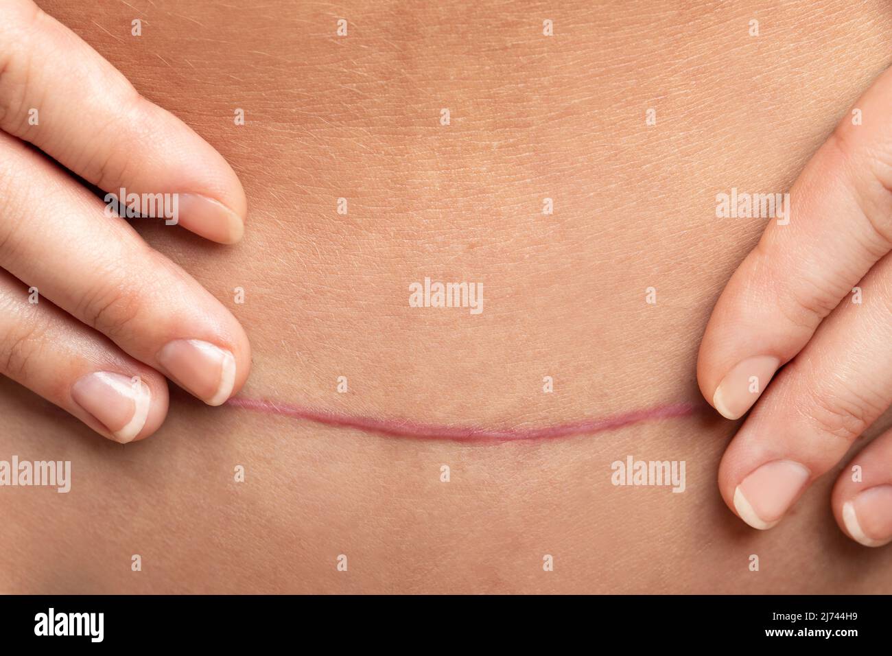 After childbirth body hi-res stock photography and images - Alamy