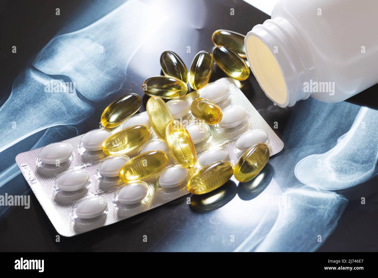 Close-up of X-ray image and different pills and capsules Stock Photo ...