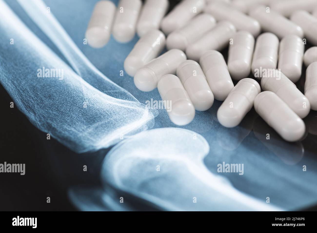 X-ray image and white capsules with dietary supplement or drug Stock ...