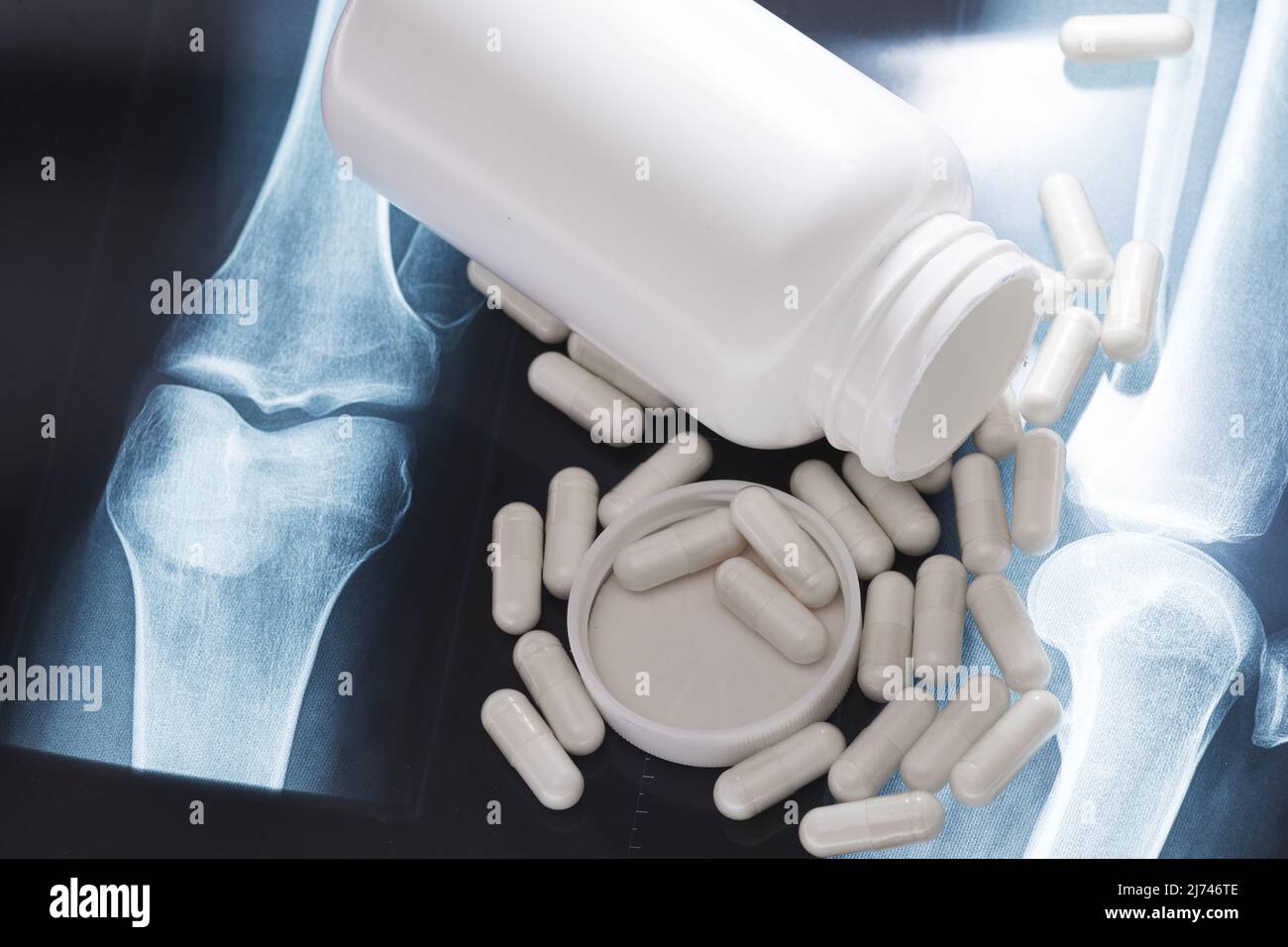 X-ray image and white capsules with dietary supplement or drug Stock ...