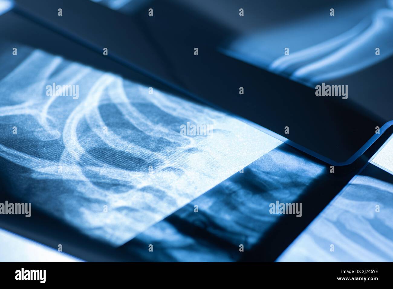 Forensic x ray hi-res stock photography and images - Alamy