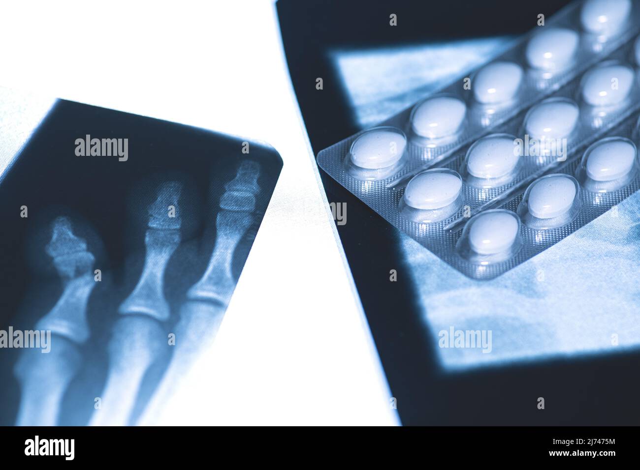 X-ray image and blister pack of white tablets Stock Photo - Alamy