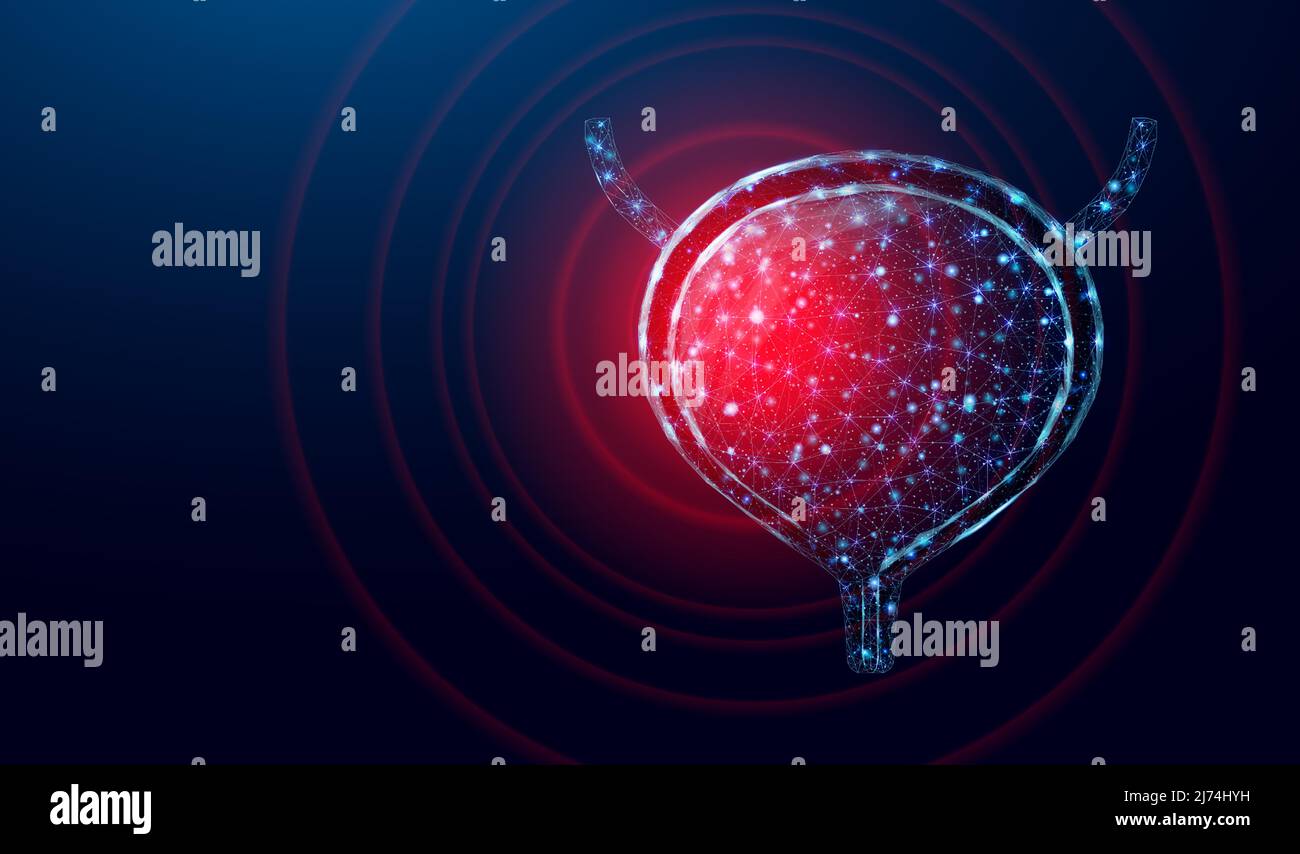 Human bladder pain. Design element for medical concept, bladder cancer ...