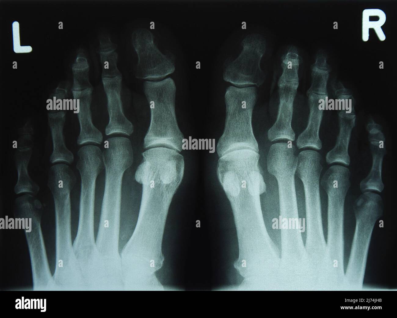 Anatomische anatomie hi-res stock photography and images - Alamy