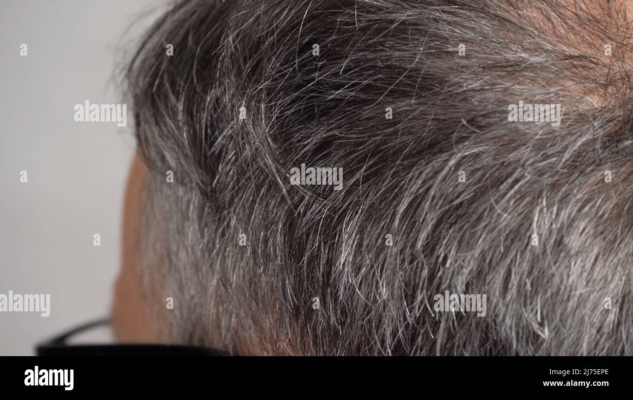 Gray hair on a man's head Stock Photo - Alamy