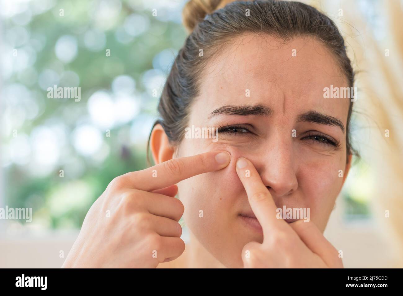 Portrait of a woman exploding a pimple on her face and with an ...