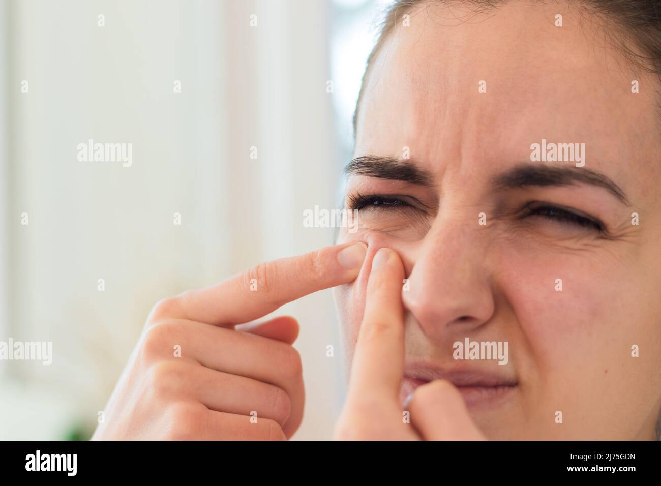 Close up portrait of teenager squeezing out a pimple, facial care and ...