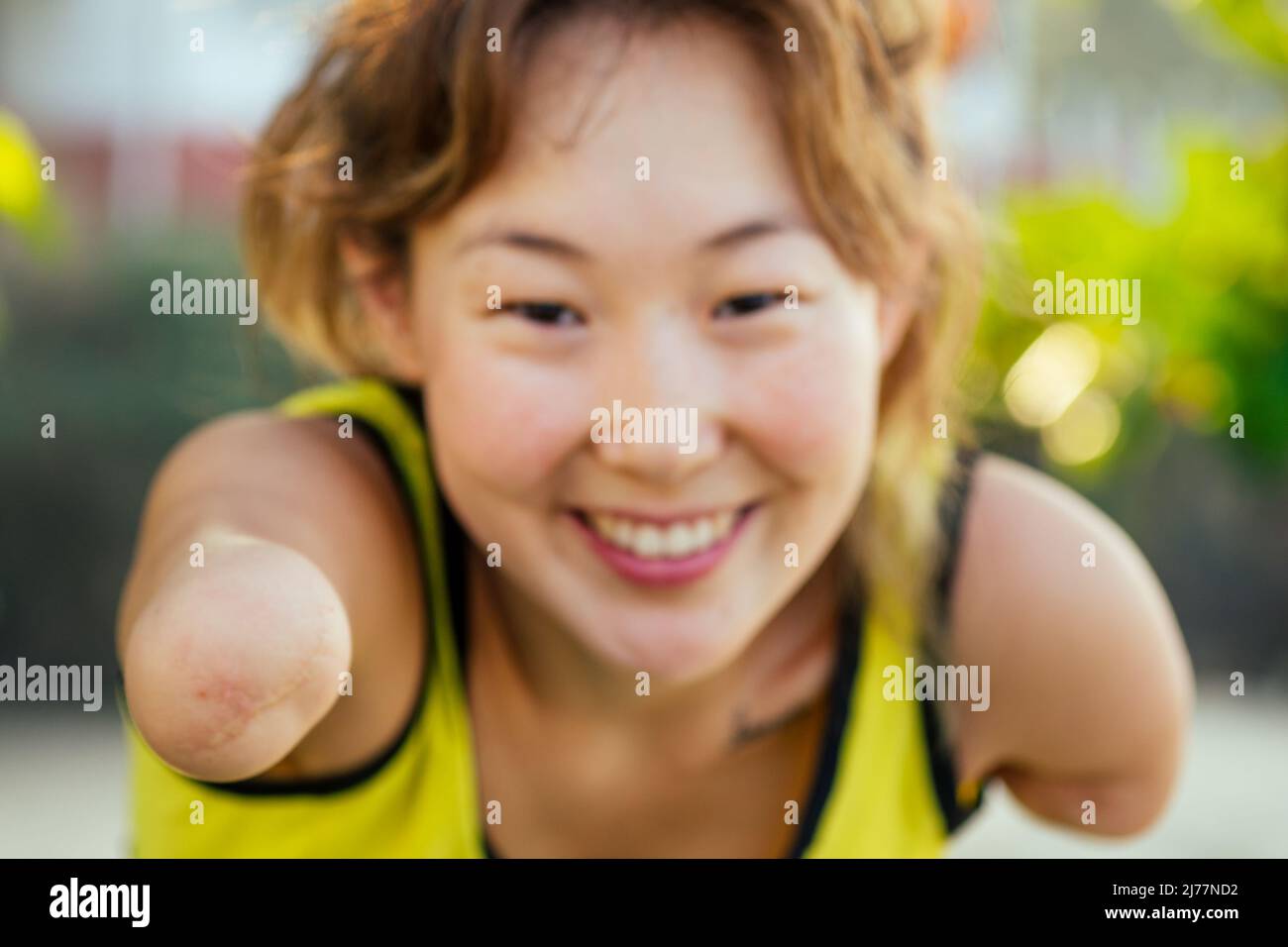 Armless disabled hi-res stock photography and images - Alamy