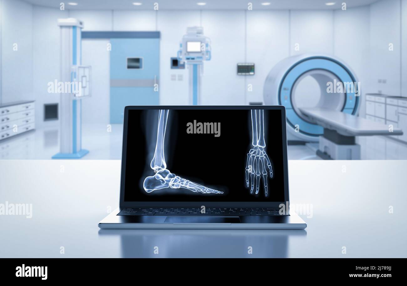Hospital radiology room with 3d rendering computer notebook display x ...