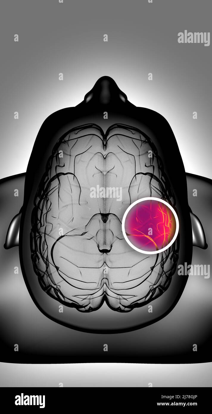 How the brain works. Synapses and neurons. Connections. Take care of ...