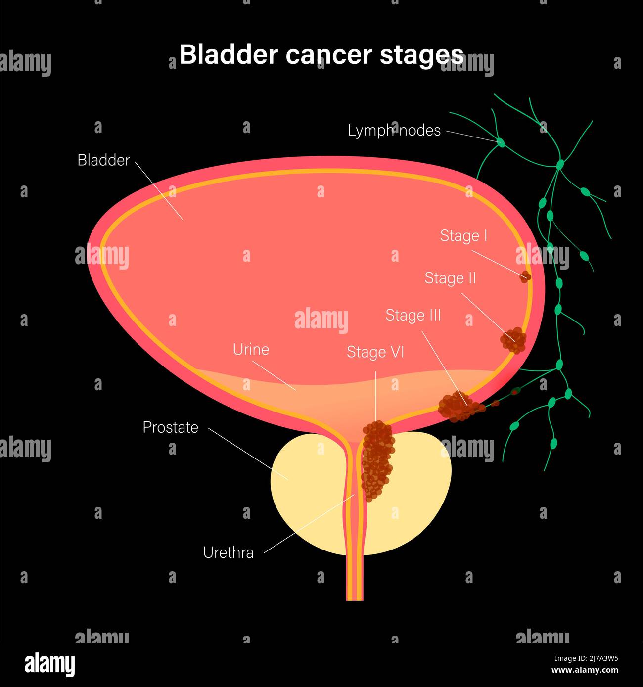 Urology artwork hi-res stock photography and images - Alamy