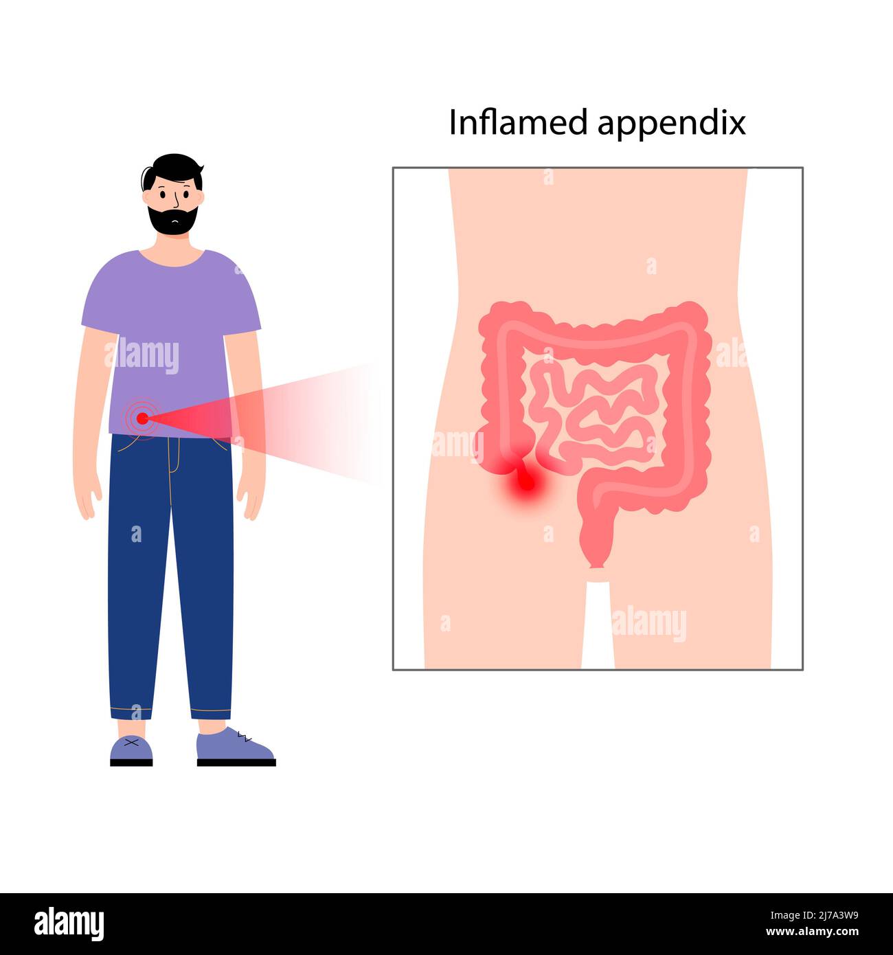 Swollen stomach cartoon hi-res stock photography and images - Alamy