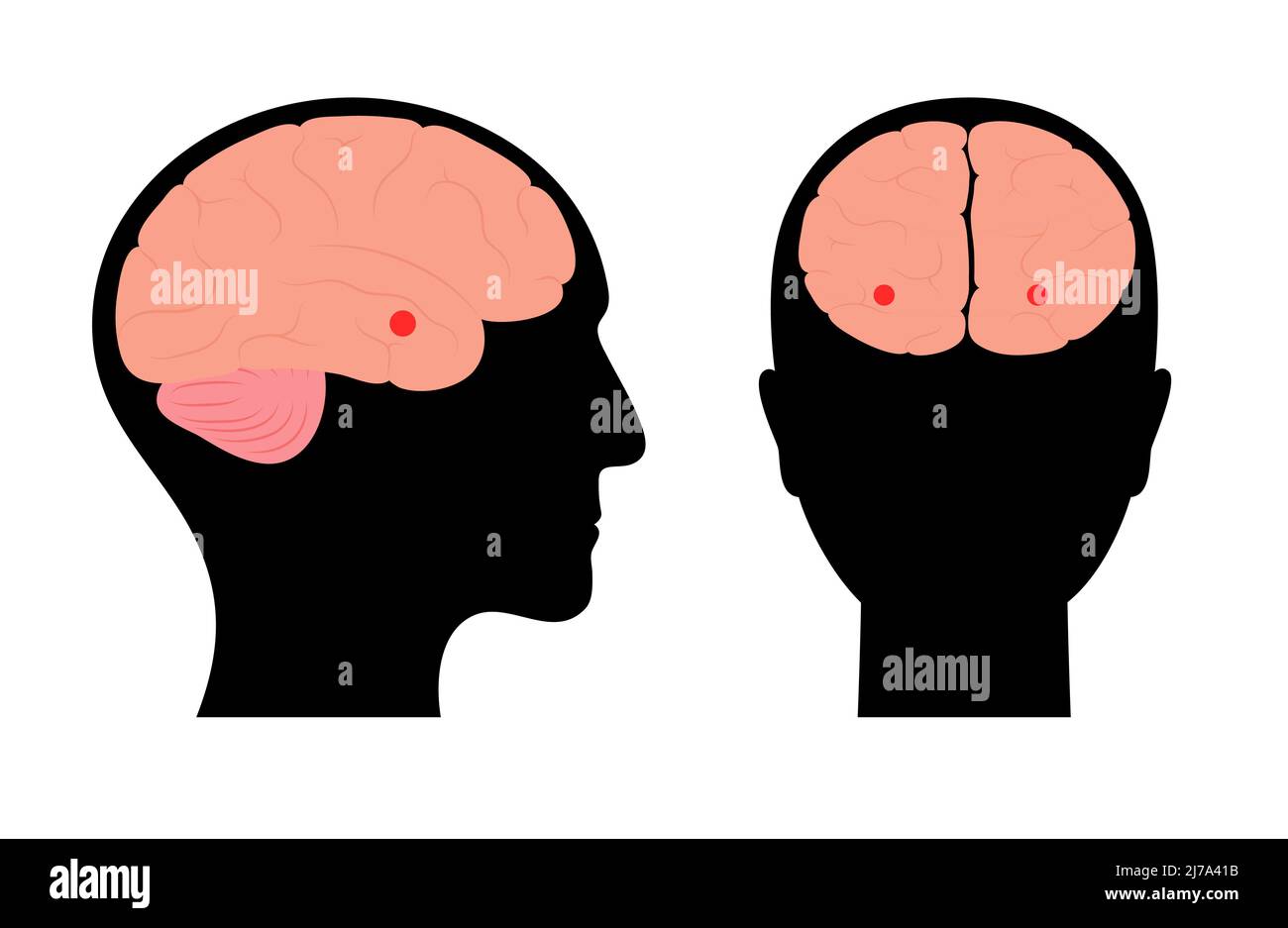 Brain amygdala anatomy, illustration Stock Photo - Alamy