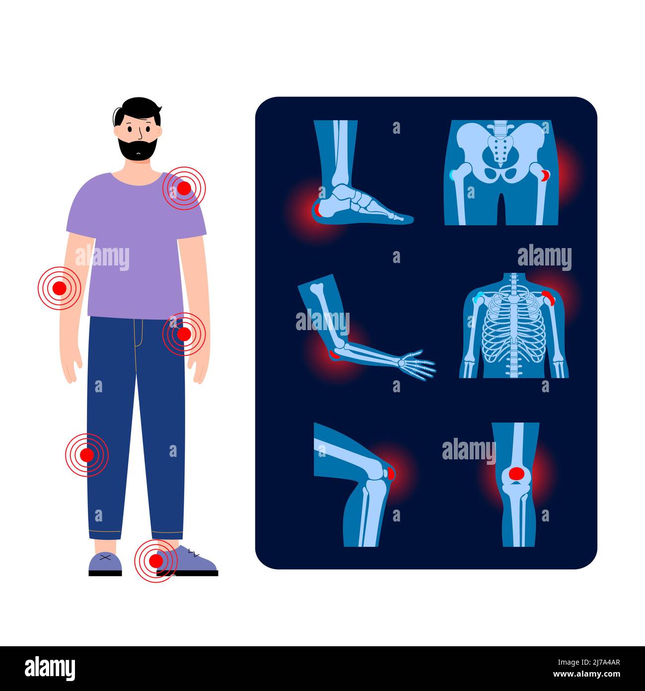 Shoulder arm foot Cut Out Stock Images & Pictures - Alamy