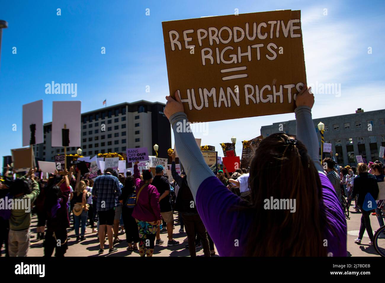 A protester holds a placard up that says "Reproductive rights = Human ...