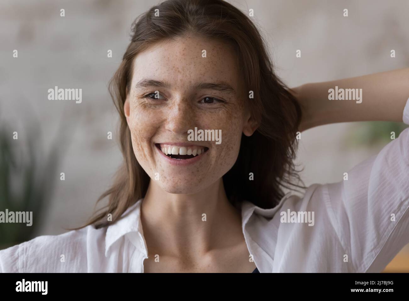 Joyful excited model girl with spotted facial skin indoor portrait ...