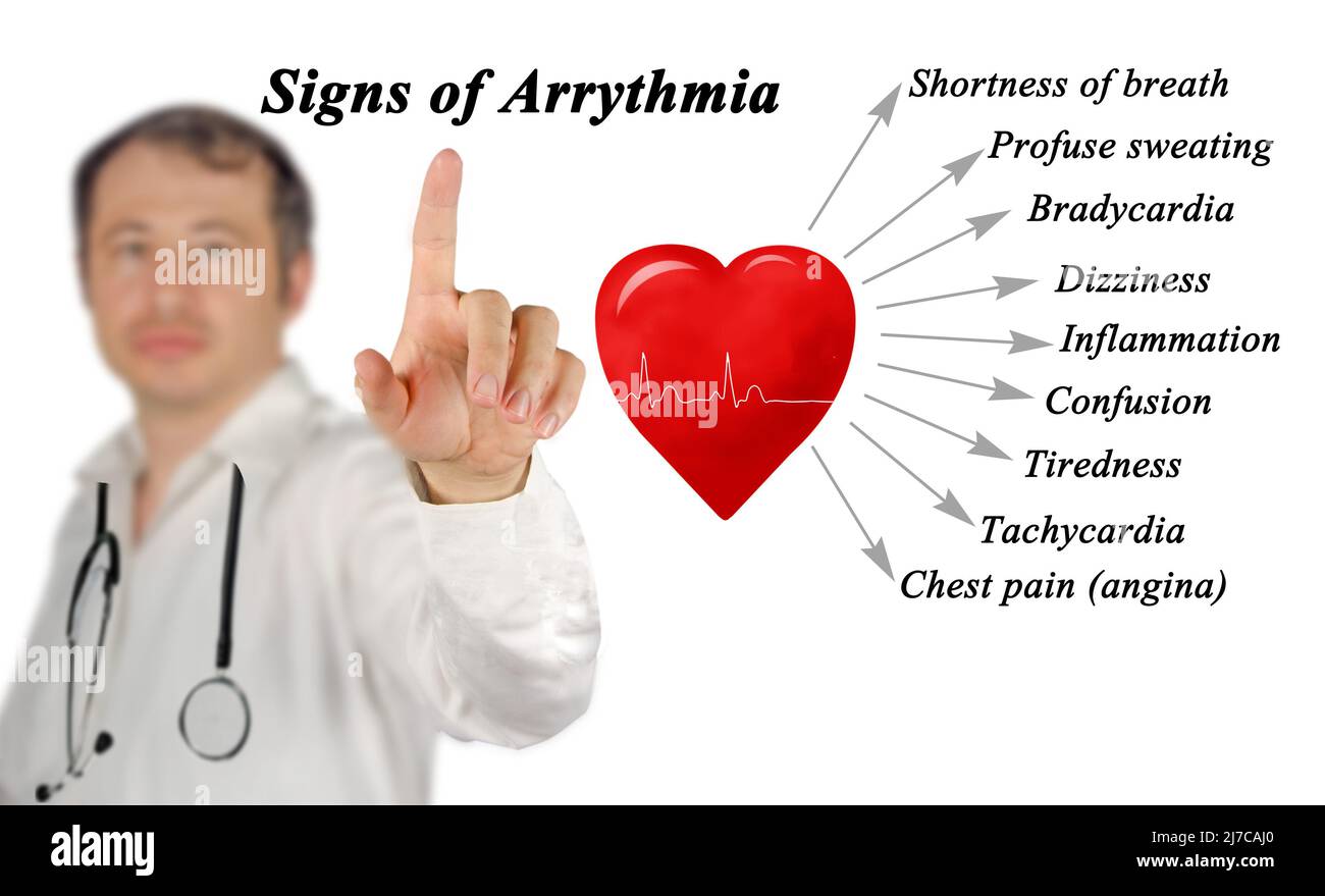 Presenting Nine Sign of Arrythmia Stock Photo - Alamy