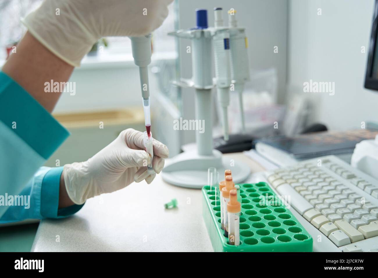 Female specialist doing analysis of blood test Stock Photo - Alamy