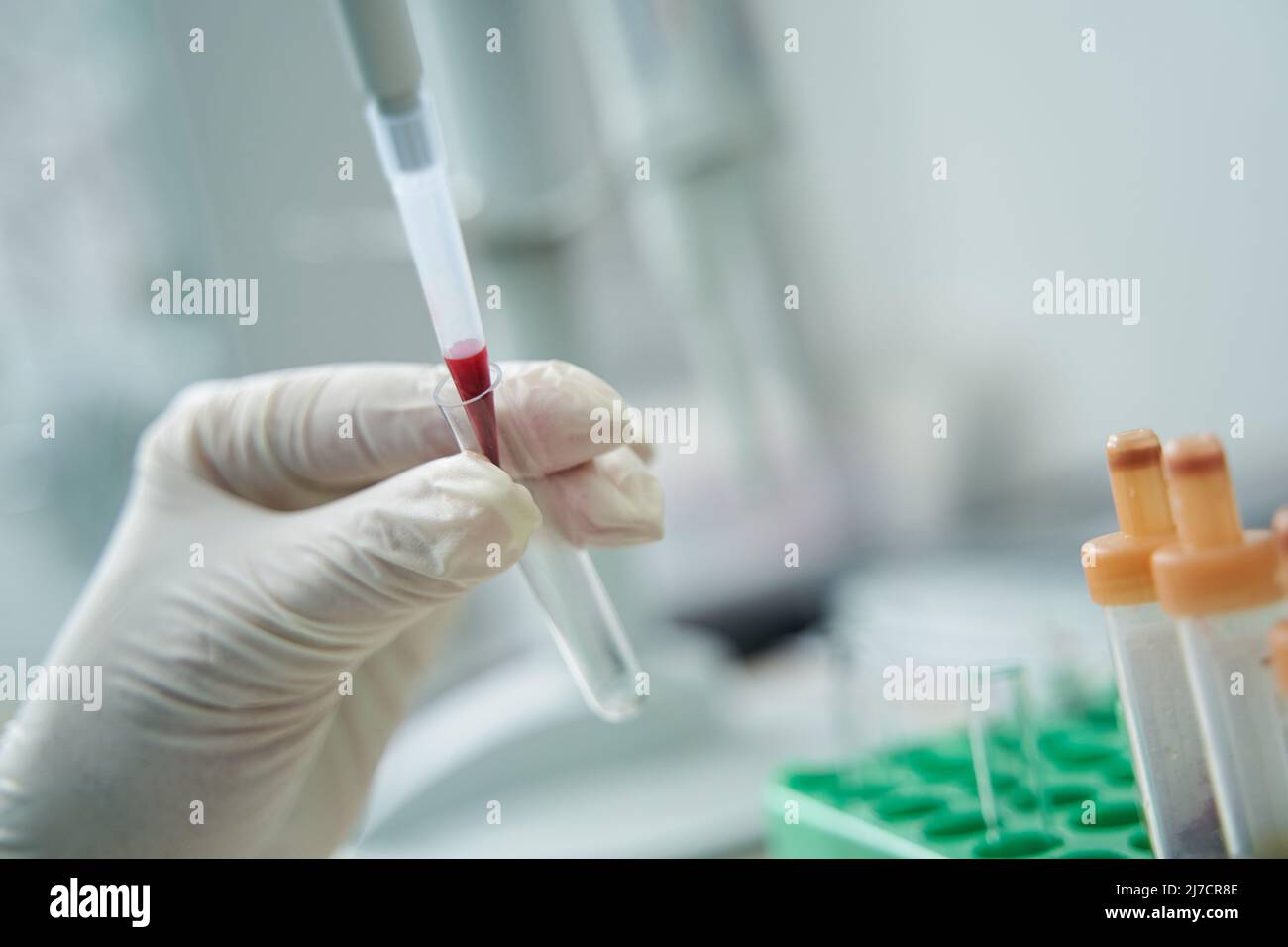 Doctor doing blood test microscope hi-res stock photography and images ...