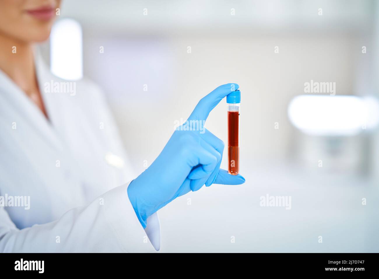 Woman holding test tube with blood and mixing machine Stock Photo - Alamy