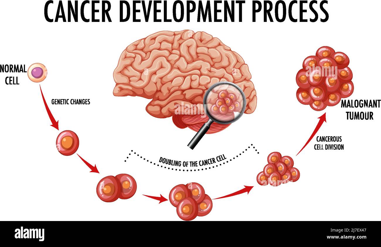 Diagram showing cancer development process illustration Stock Vector ...
