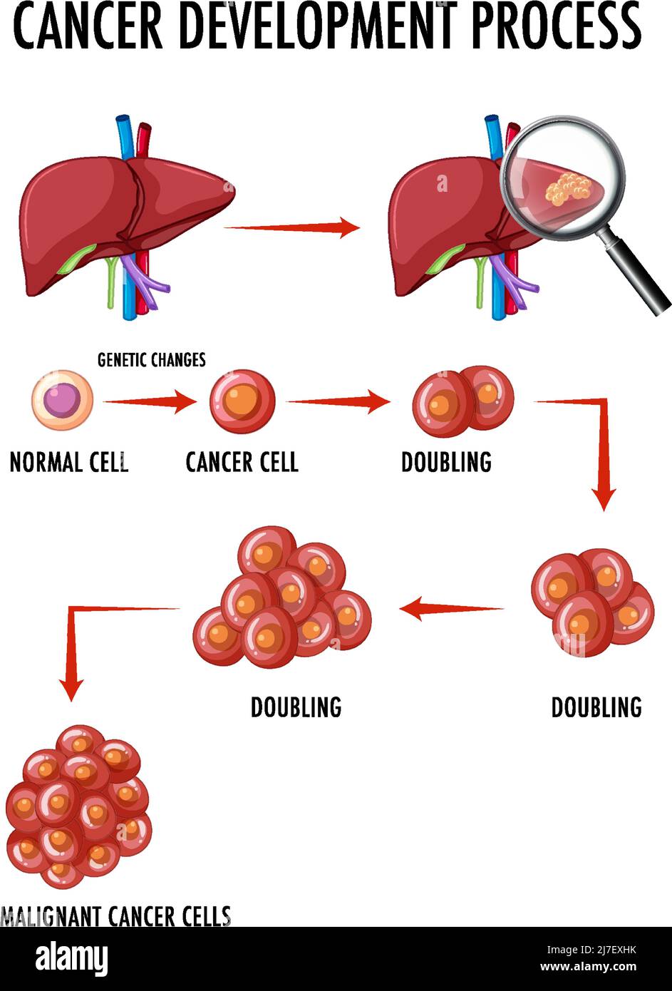 Cancer Development Diagram