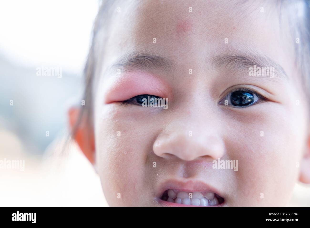 Stye child hi-res stock photography and images - Alamy