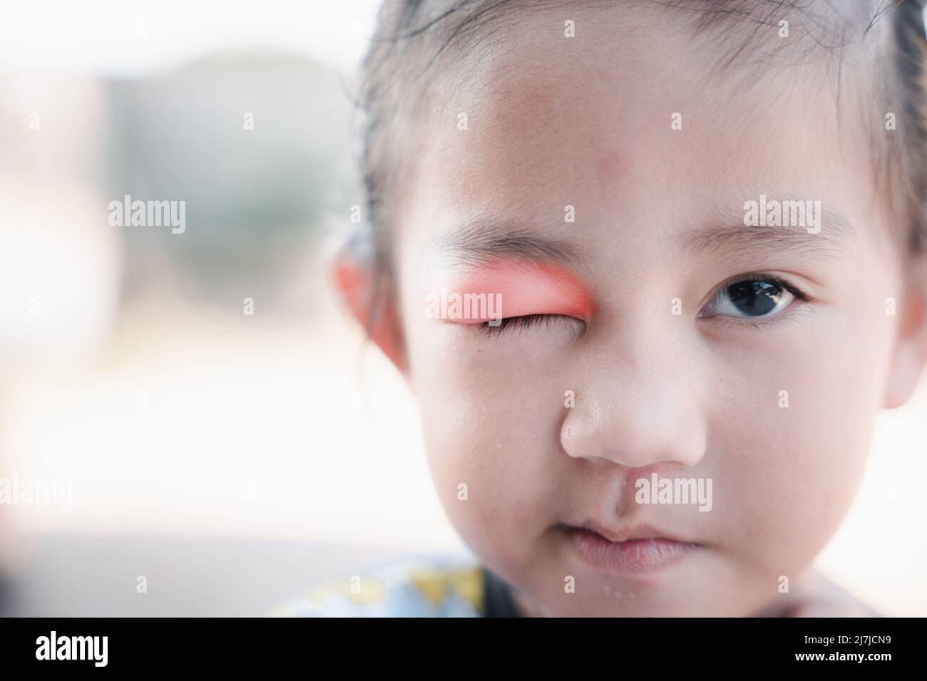 Stye child hi-res stock photography and images - Alamy