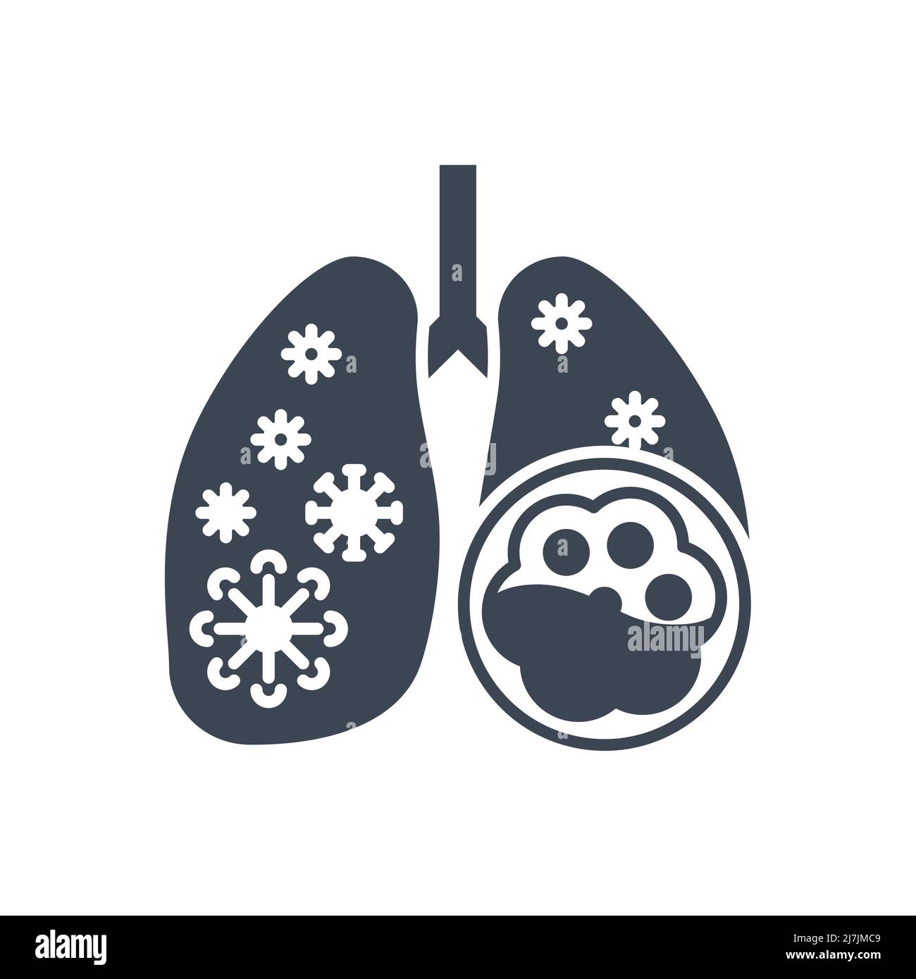 Fluid on the lung Stock Vector Images - Alamy