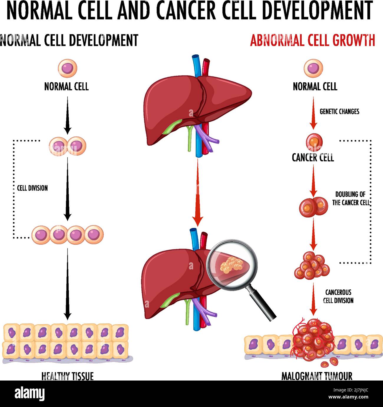 Diagram showing normal and cancer cell illustration Stock Vector Image ...