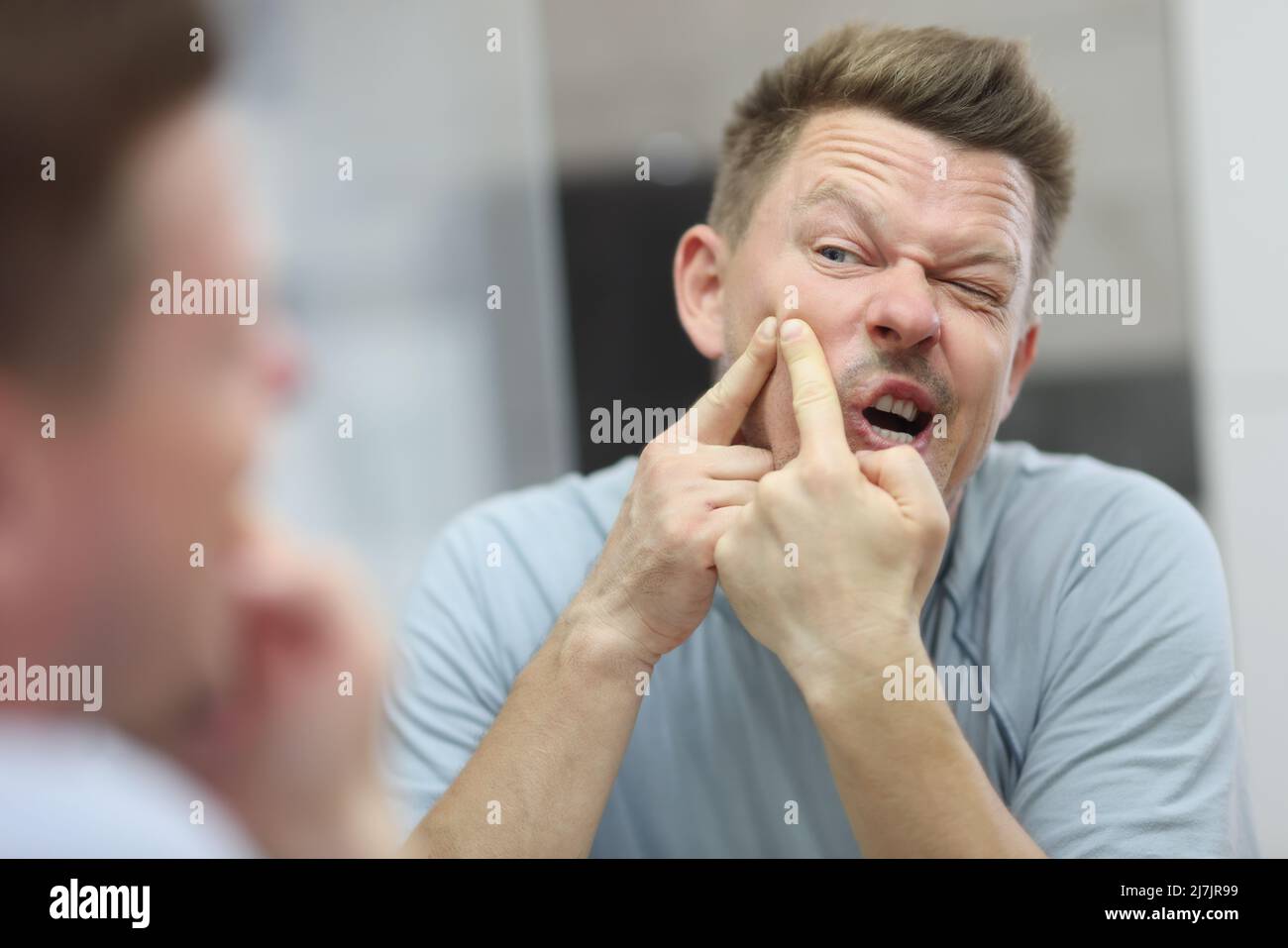 Man squeeze and get rid of pimple on face looking in mirror Stock Photo ... Man squeeze and get rid of pimple on face looking in mirror Stock Photo ...