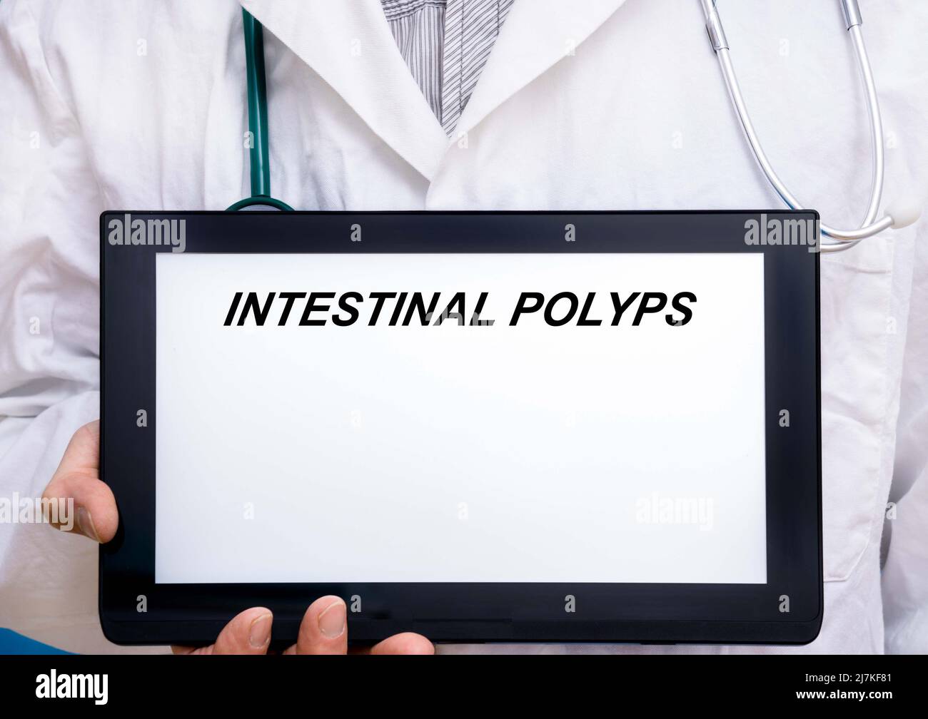 Intestinal Polyps. Doctor with rare or orphan disease text on tablet ...